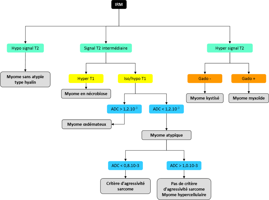 Myomes utérins – PinkyBone