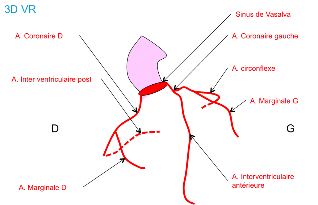 Anatomie – Coronaires – PinkyBone