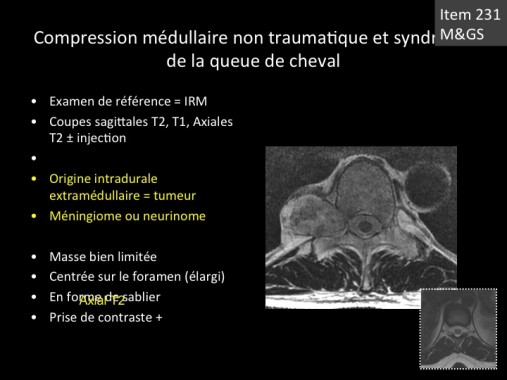 Diapositive096 – PinkyBone