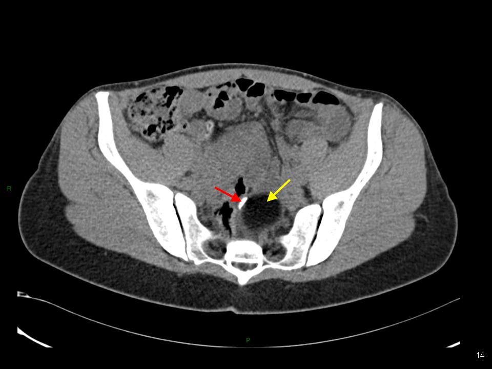 Diapositive14 – PinkyBone