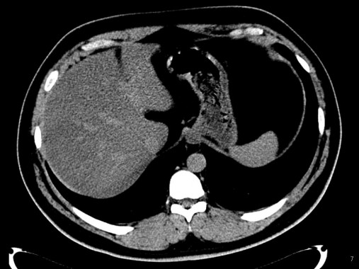 Diapositive17 – PinkyBone