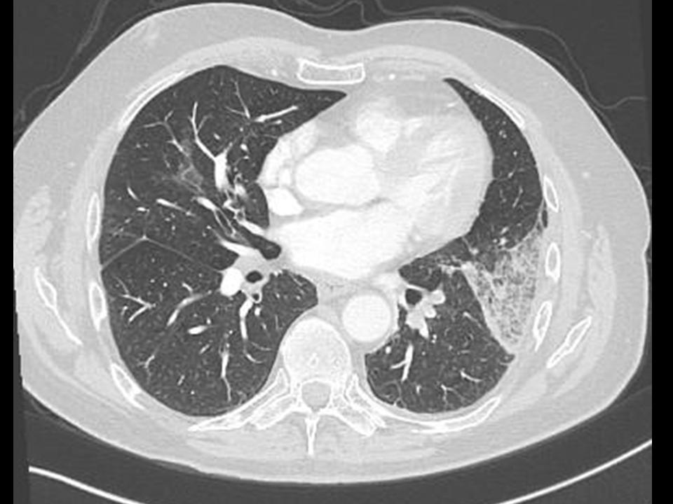 Diapositive17 – PinkyBone