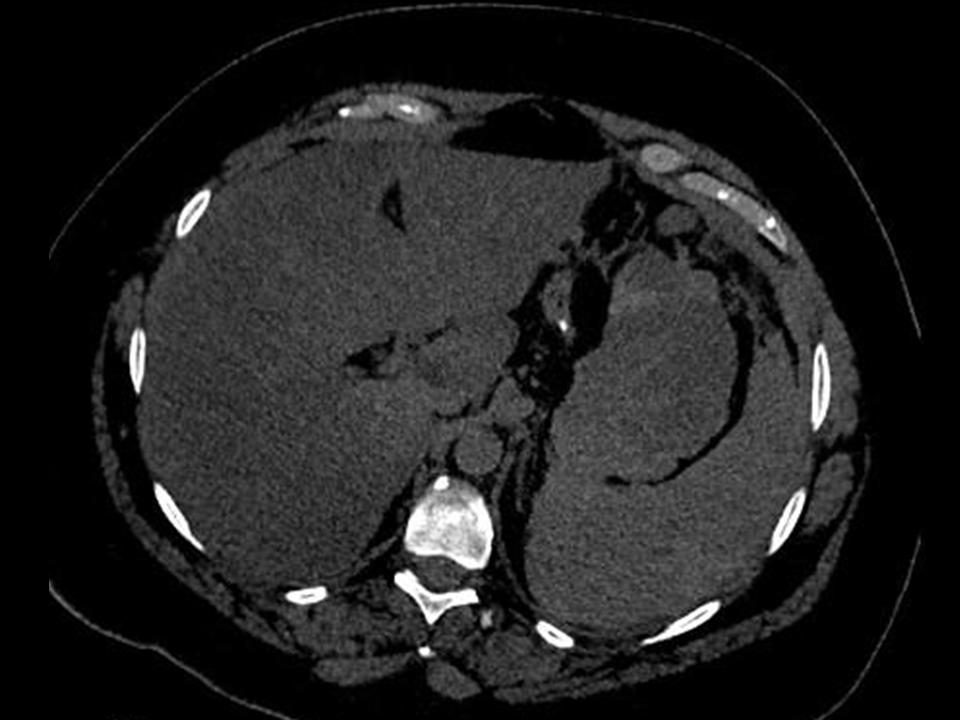 Diapositive22 – PinkyBone