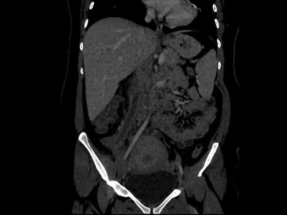 Diapositive6 – PinkyBone