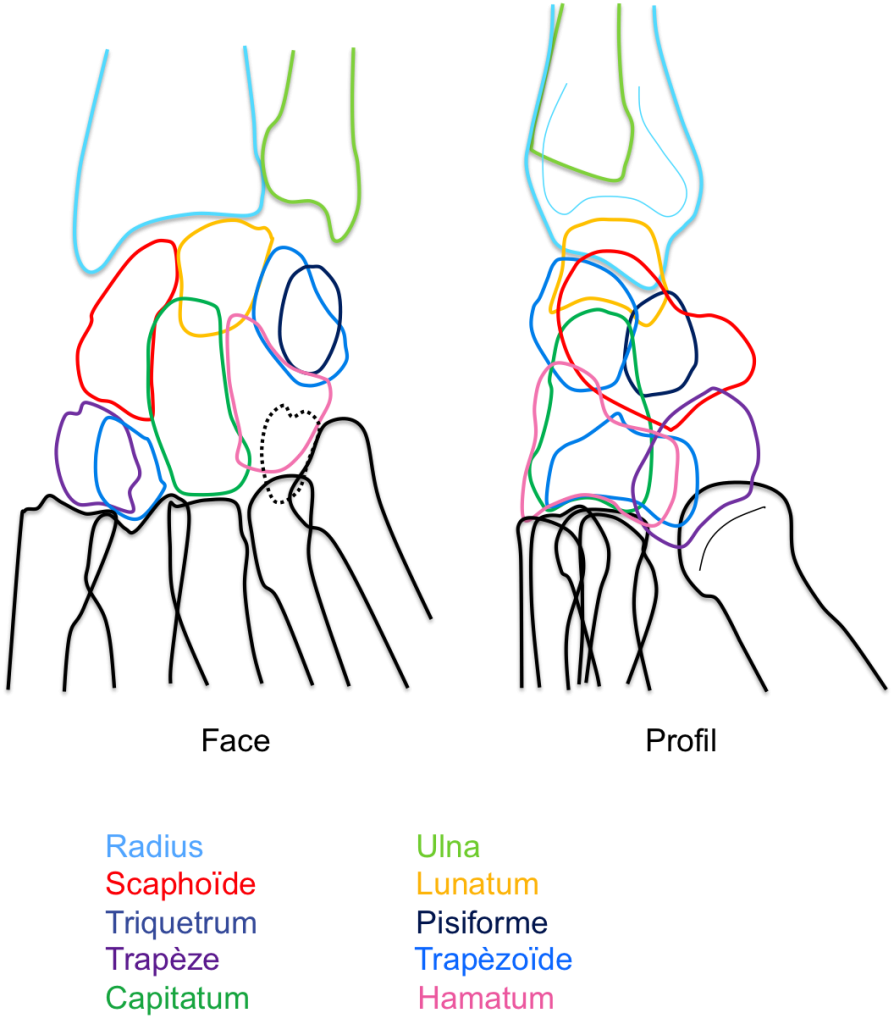 Poignet – PinkyBone