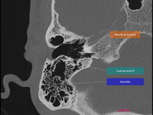 Anatomie – Rocher – PinkyBone