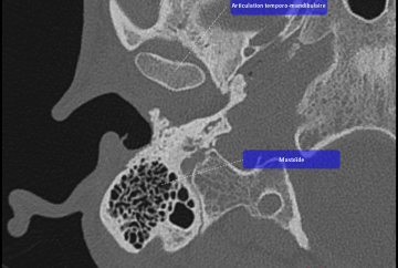 Rocher Archives - PinkyBone