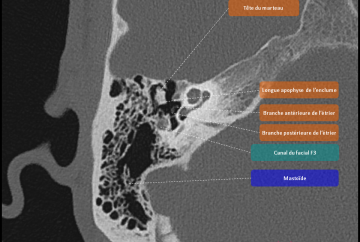 Anatomie - Rocher - PinkyBone