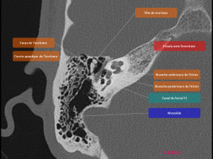 Rocher – PinkyBone