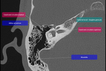 Rocher Archives - PinkyBone