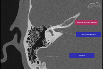 Rocher Archives - PinkyBone