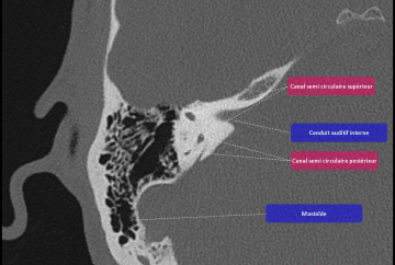 ORL Archives - PinkyBone