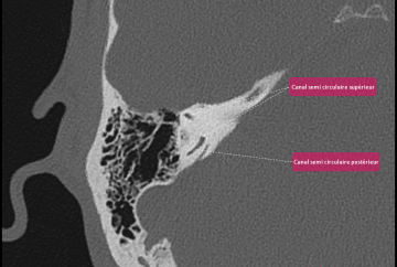 Rocher Archives - PinkyBone