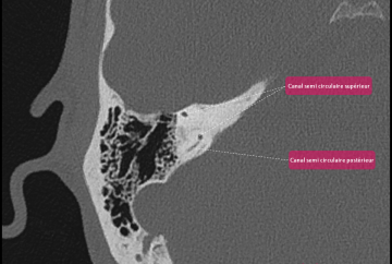 ORL Archives - PinkyBone