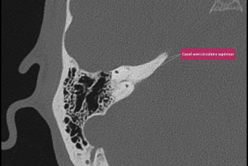 Anatomie - Rocher - PinkyBone