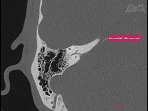 Anatomie du rocher – PinkyBone