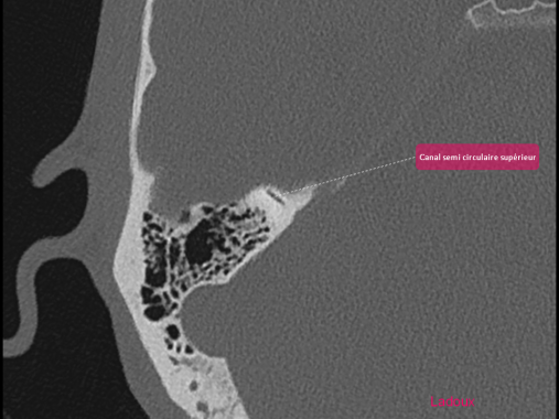 Anatomie du rocher – PinkyBone