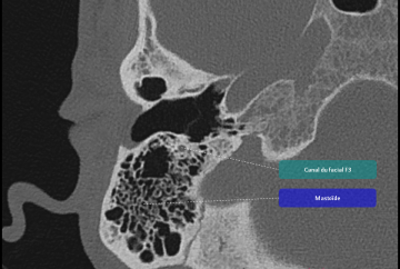 Rocher Archives - PinkyBone