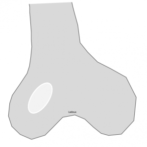 Lodwick – PinkyBone