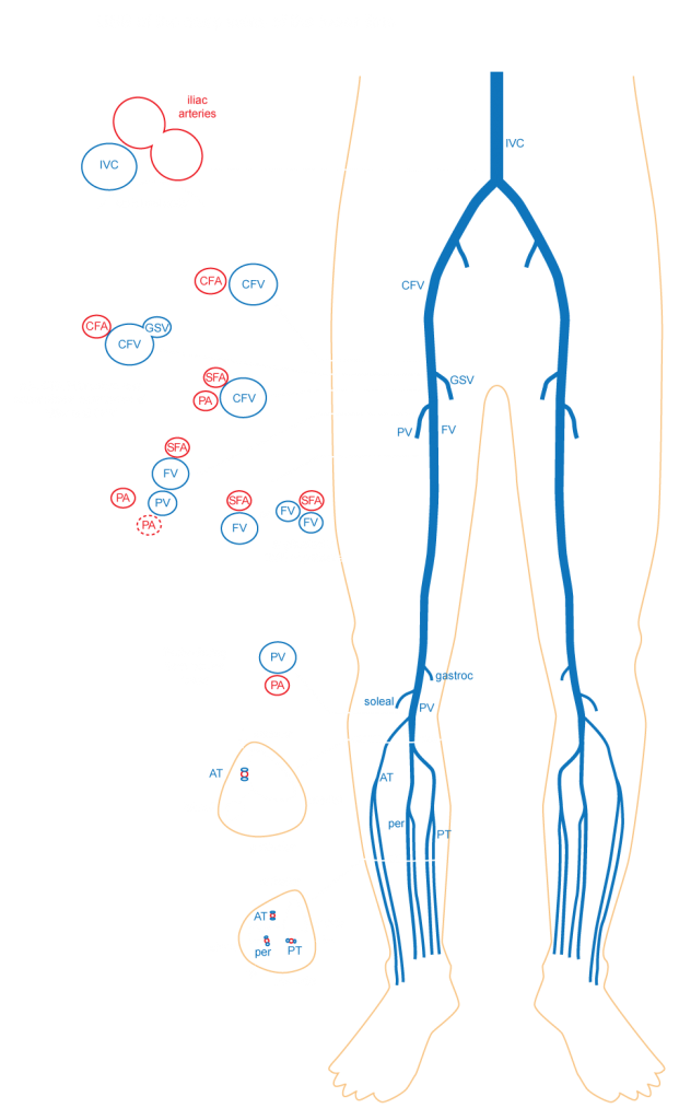 Thrombose veineuse du membre inférieur – PinkyBone