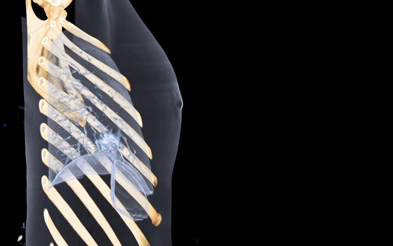 img_56bdc27ecd8ae – PinkyBone