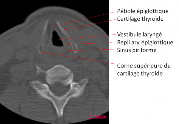Anatomie – Larynx – PinkyBone